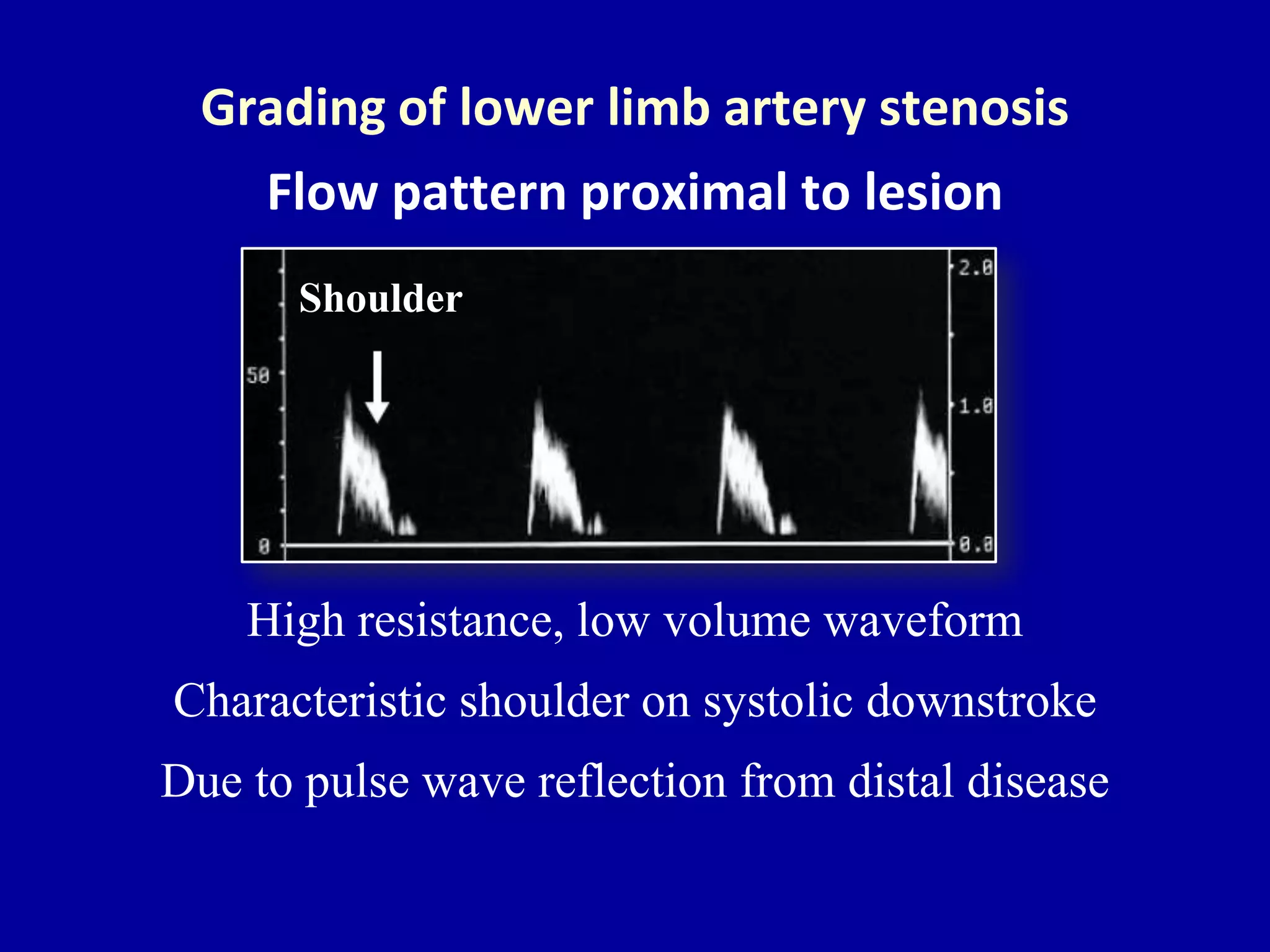 Doppler ultrasound of lower limb arteries | PPTX