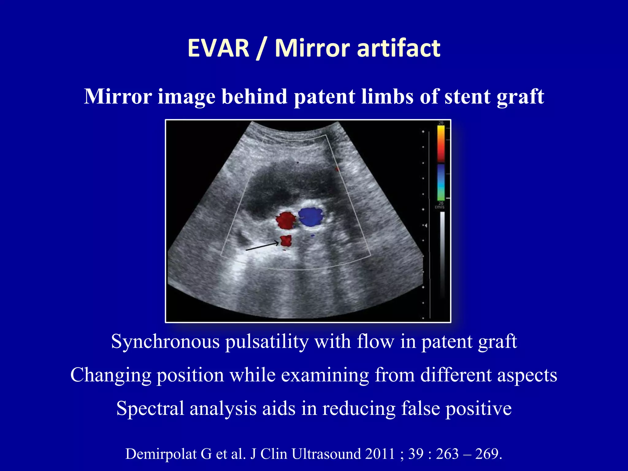 Doppler ultrasound of lower limb arteries | PPTX