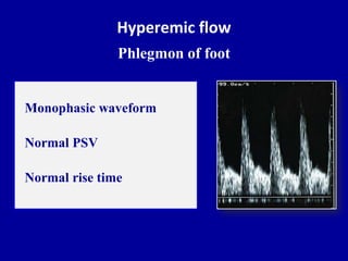 Doppler ultrasound of lower limb arteries | PPTX