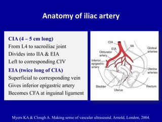Doppler ultrasound of lower limb arteries | PPTX