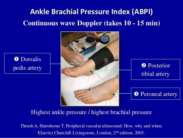 Doppler ultrasound of lower limb arteries