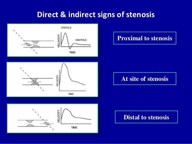 Doppler ultrasound of lower limb arteries