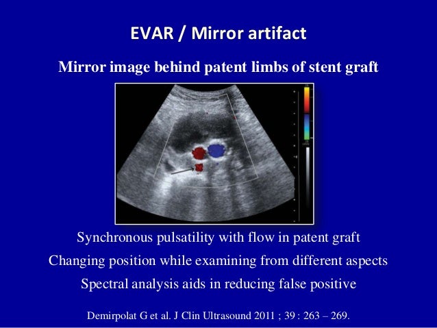 Doppler ultrasound of lower limb arteries