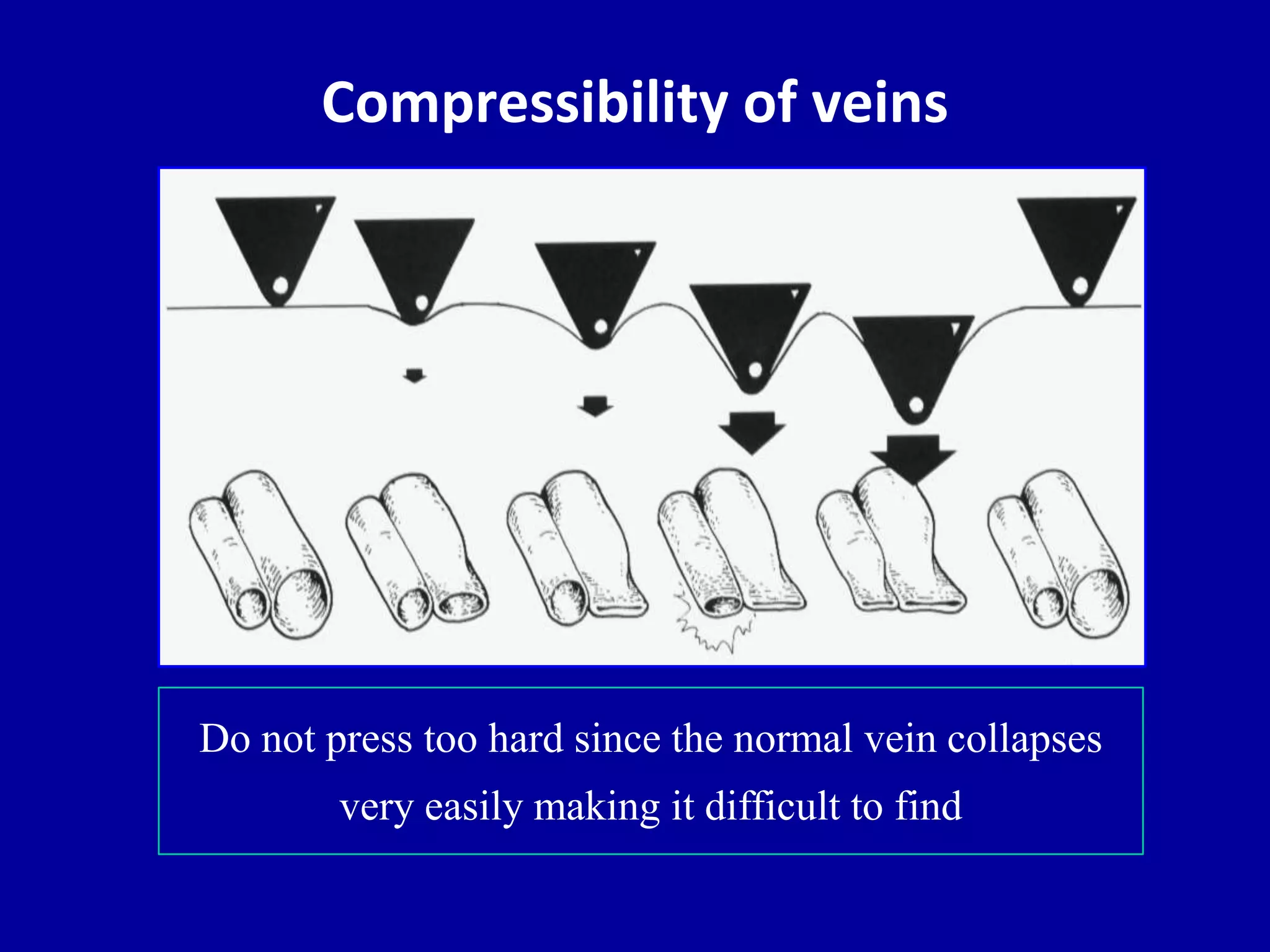 Doppler ultrasound of normal venous flow | PPTX