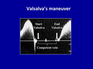 Doppler ultrasound of normal venous flow | PPTX