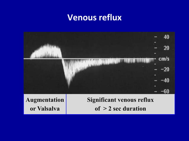Doppler ultrasound of normal venous flow | PPTX