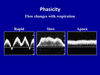 Doppler ultrasound of normal venous flow | PPTX