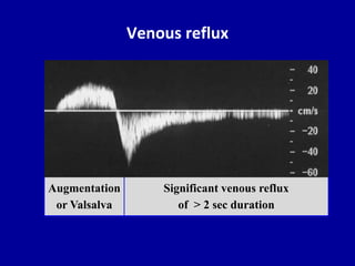 Doppler ultrasound of normal venous flow | PPT