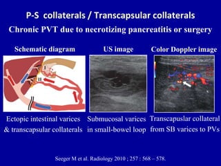 Doppler ultrasound of portal vein thrombosis | PPTX