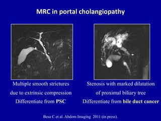 Doppler ultrasound of portal vein thrombosis | PPTX