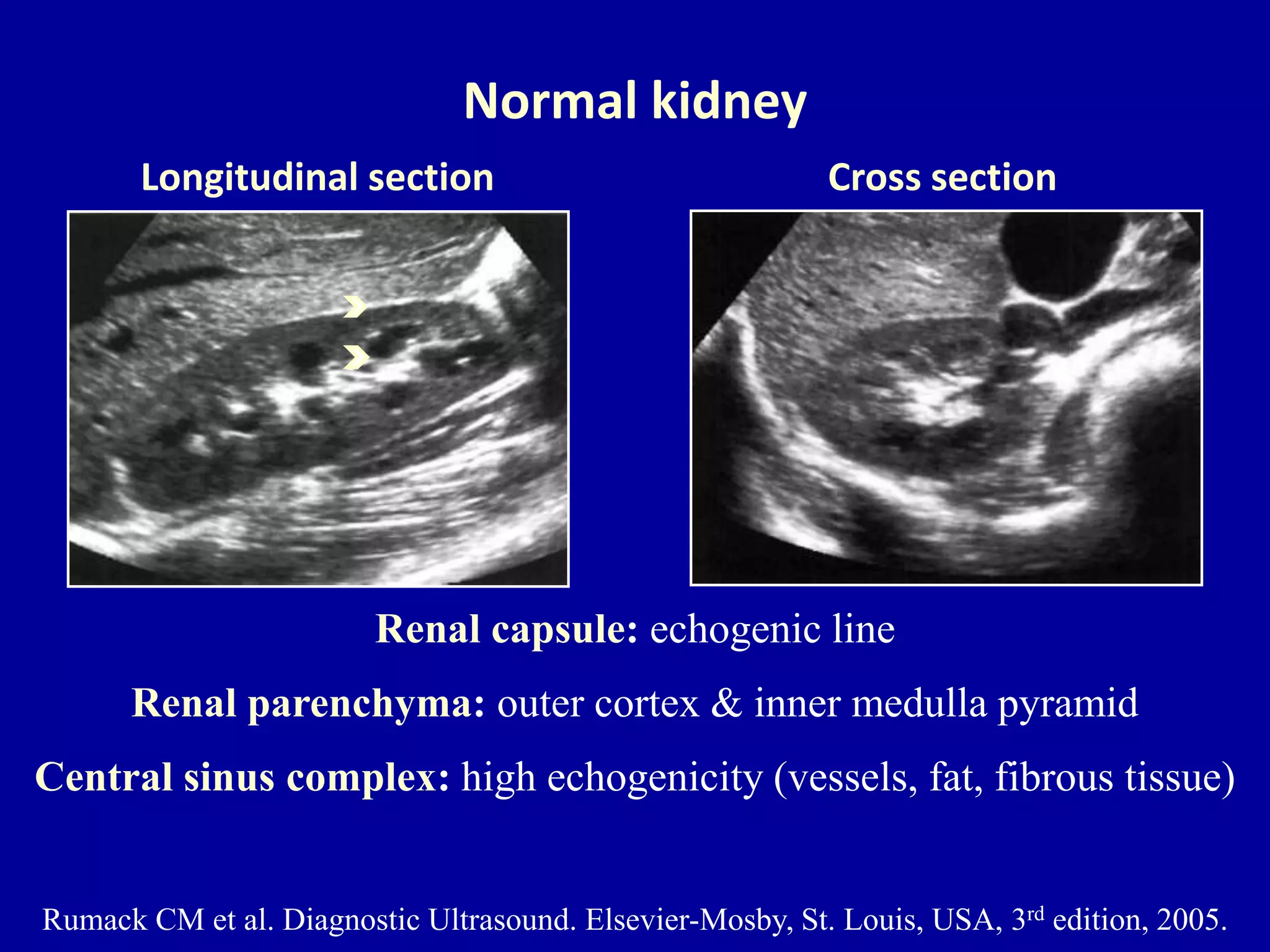 Doppler ultrasound of the kidneys | PPTX