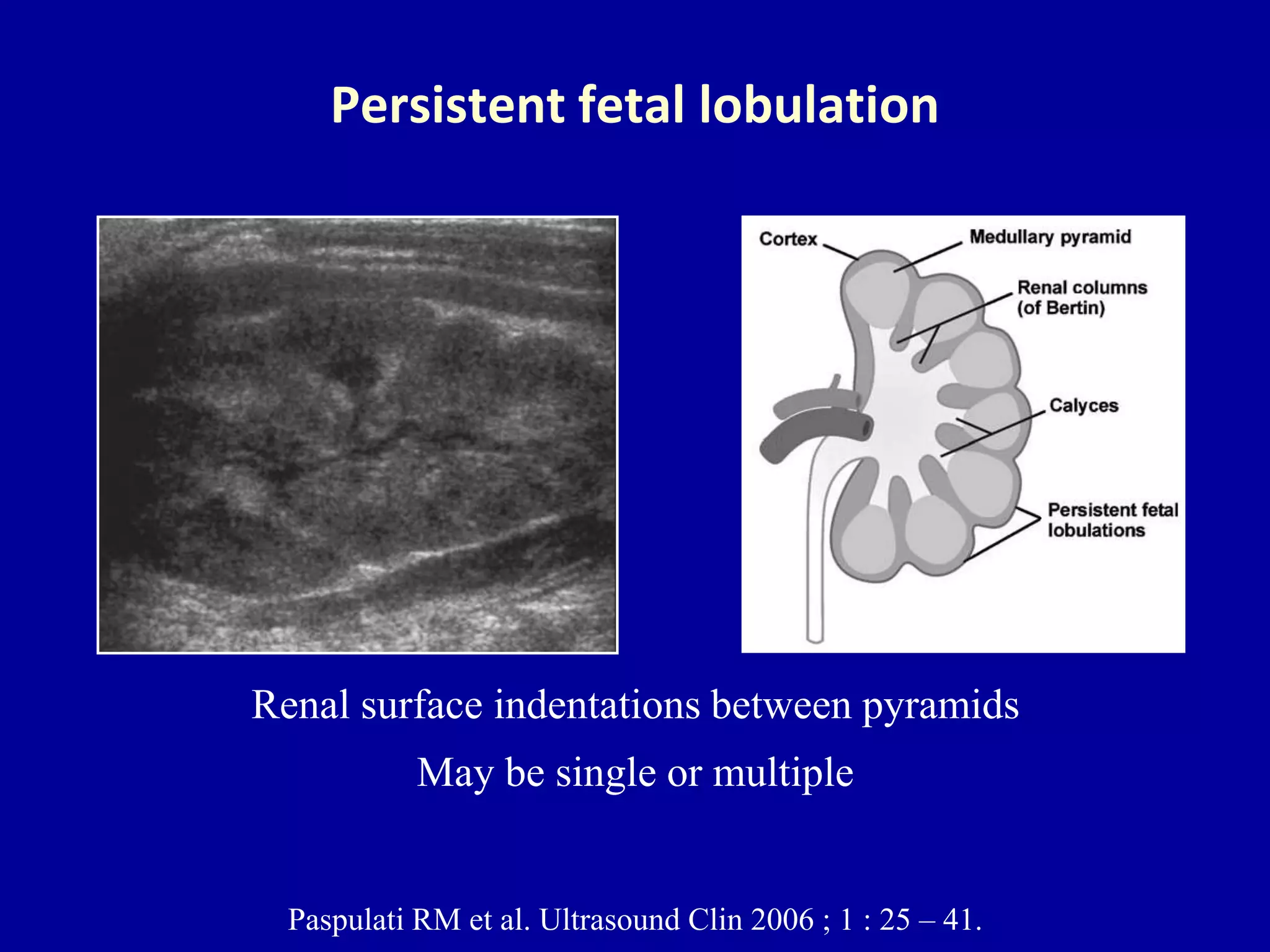 Doppler ultrasound of the kidneys | PPTX