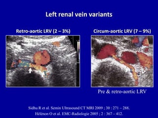 Doppler ultrasound of the kidneys | PPTX