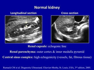 Healthy Kidney Cross Section