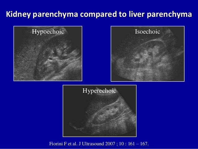 Doppler ultrasound of the kidneys
