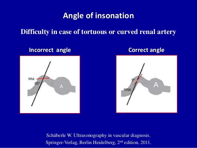 Doppler ultrasound of the kidneys