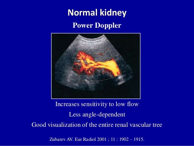 Doppler Ultrasound Of The Kidney