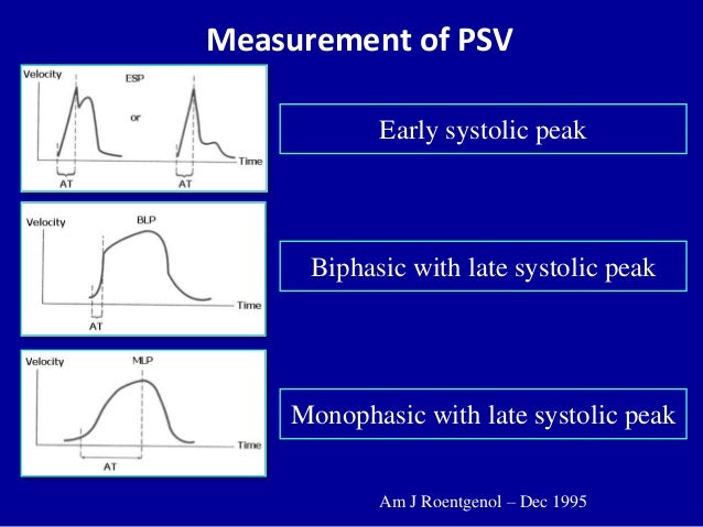 Doppler ultrasound of the kidneys