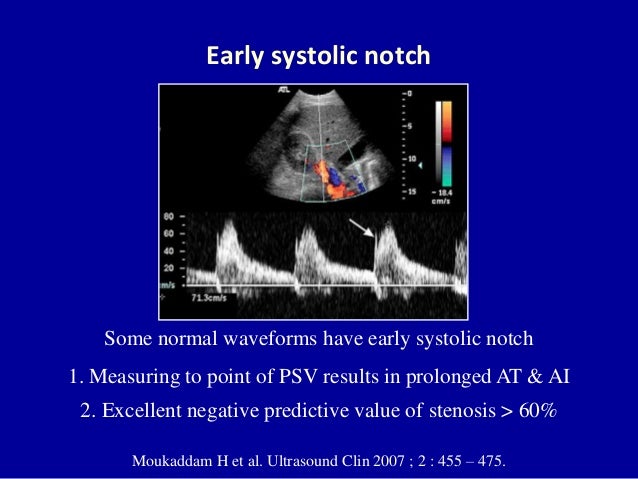 Doppler ultrasound of the kidneys