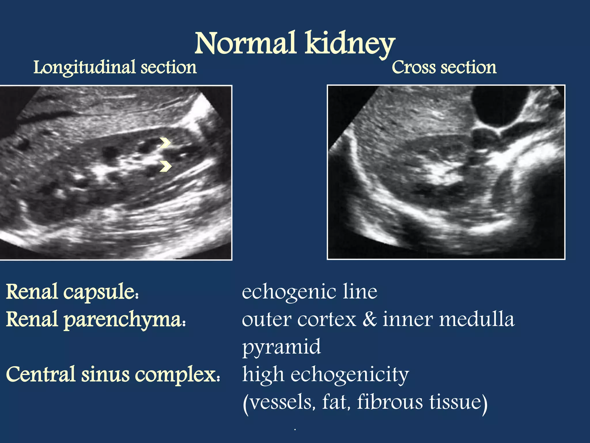 Doppler ultrasound of the Kidney | PPTX