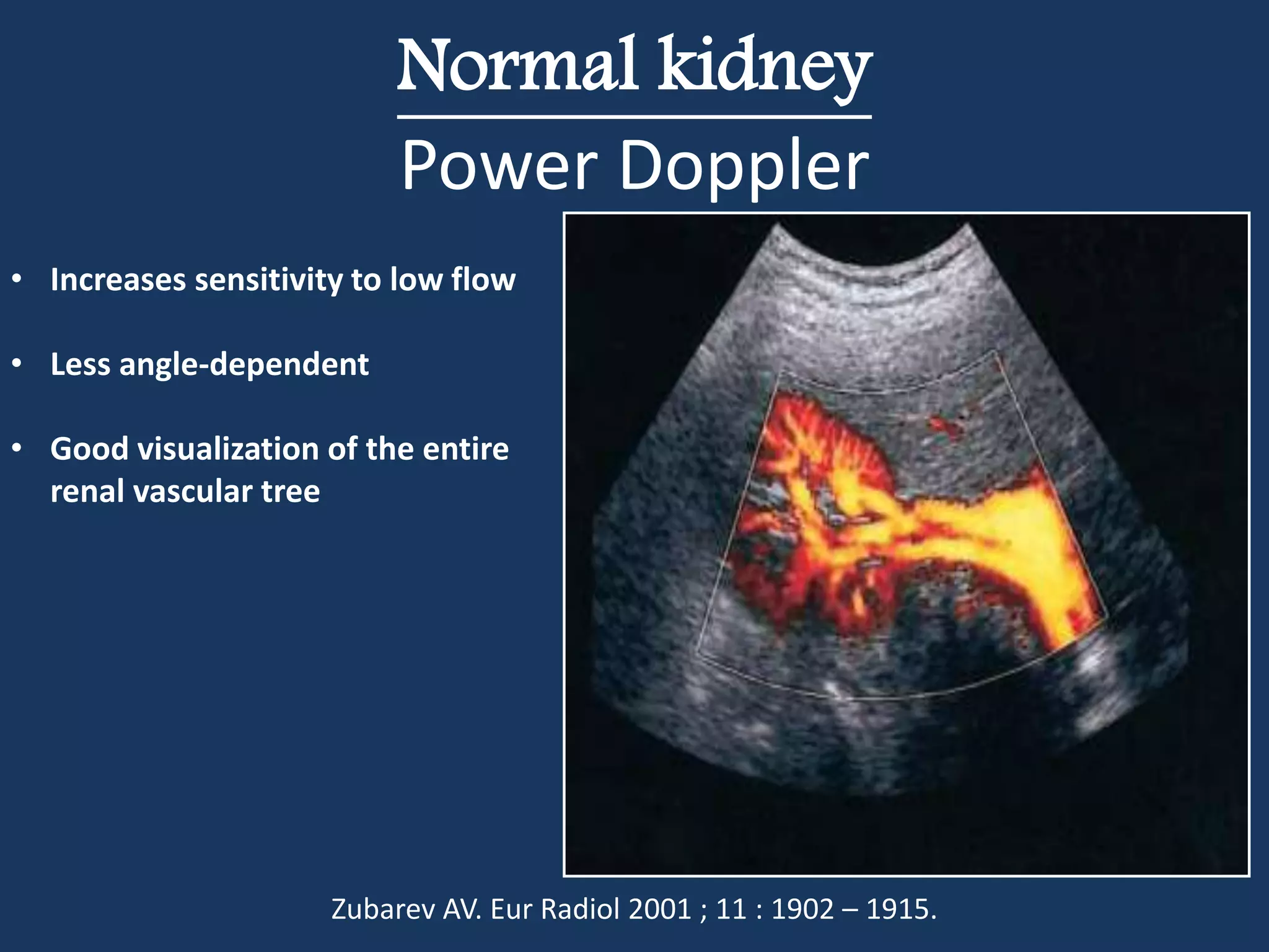 Doppler ultrasound of the Kidney | PPTX