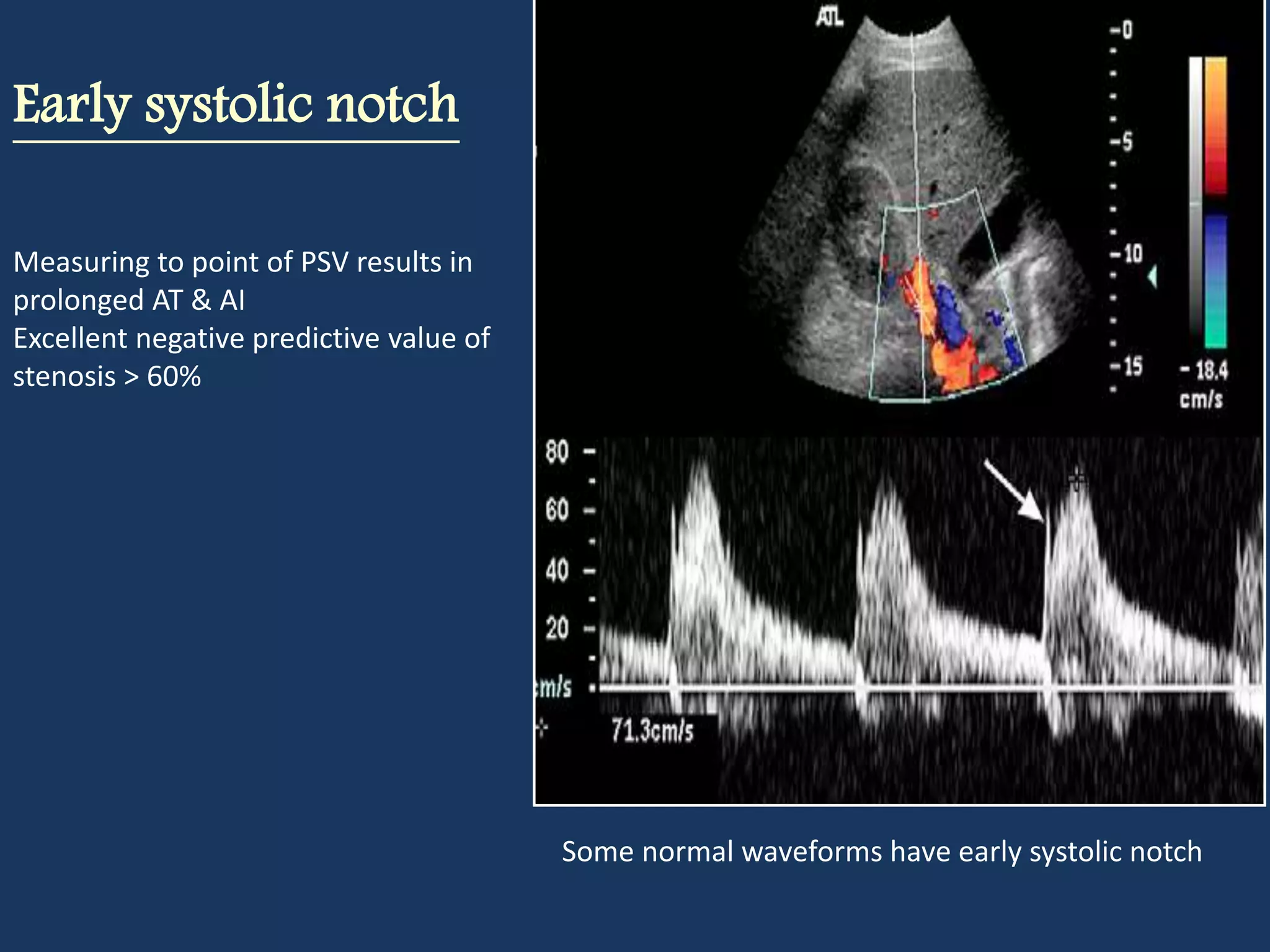 Doppler ultrasound of the Kidney | PPTX