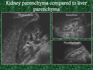 Doppler ultrasound of the Kidney | PPTX