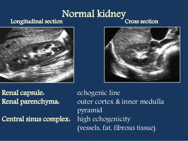 Doppler ultrasound of the Kidney