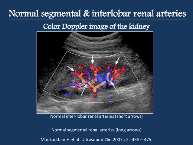 Doppler ultrasound of the Kidney