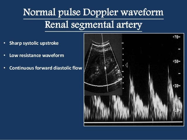 Doppler ultrasound of the Kidney