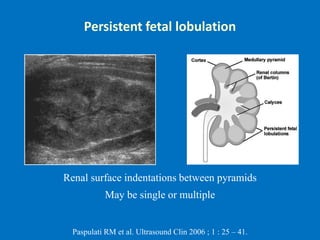 Doppler ultrasound of the kidneys 1 | PPTX