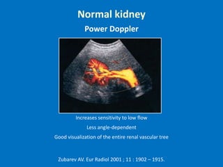 Doppler ultrasound of the kidneys 1 | PPTX