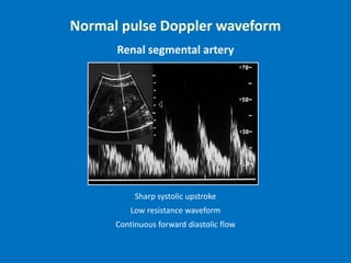 Doppler ultrasound of the kidneys 1 | PPTX