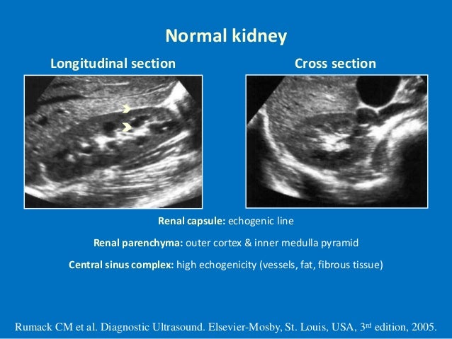 Doppler ultrasound of the kidneys 1