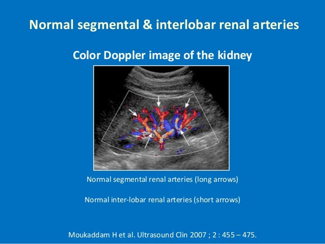 Doppler ultrasound of the kidneys 1