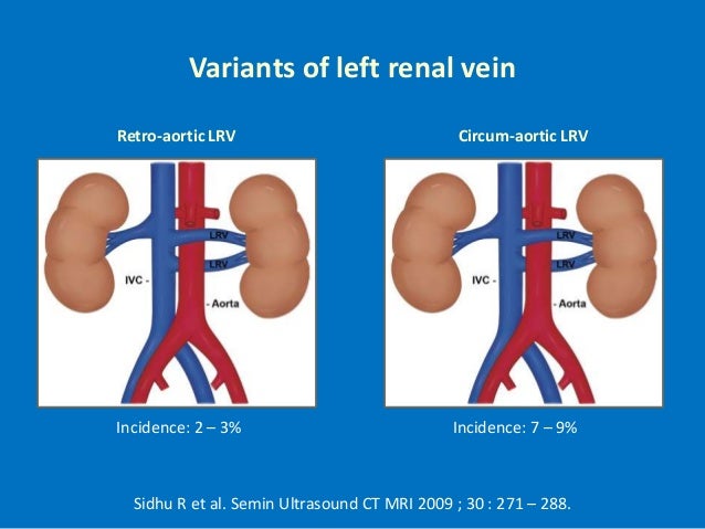Doppler ultrasound of the kidneys 1