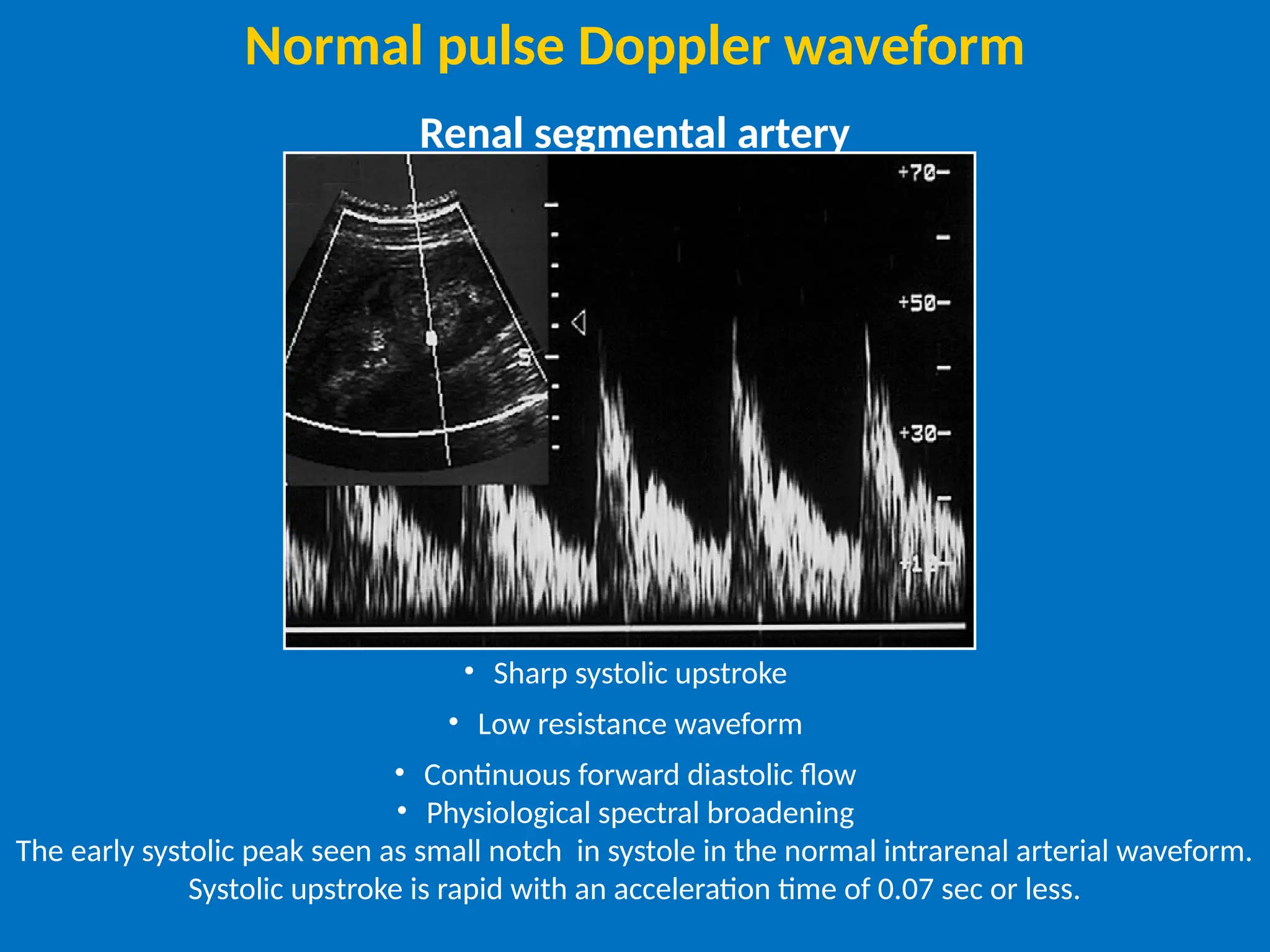 dopplerultrasoundofthekidneys1-140320041214-phpapp02 (1) (1).pptx