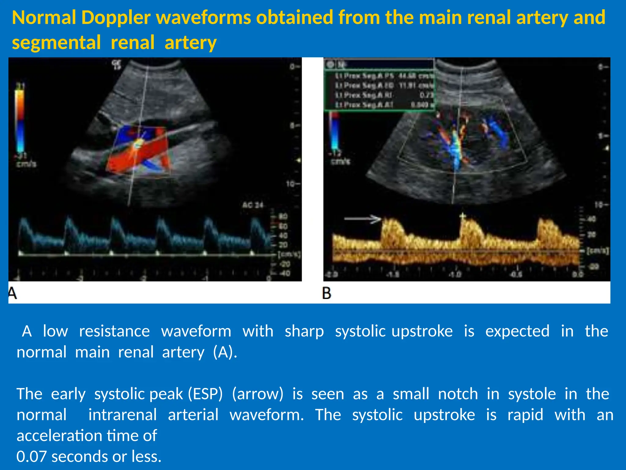 dopplerultrasoundofthekidneys1-140320041214-phpapp02 (1) (1).pptx