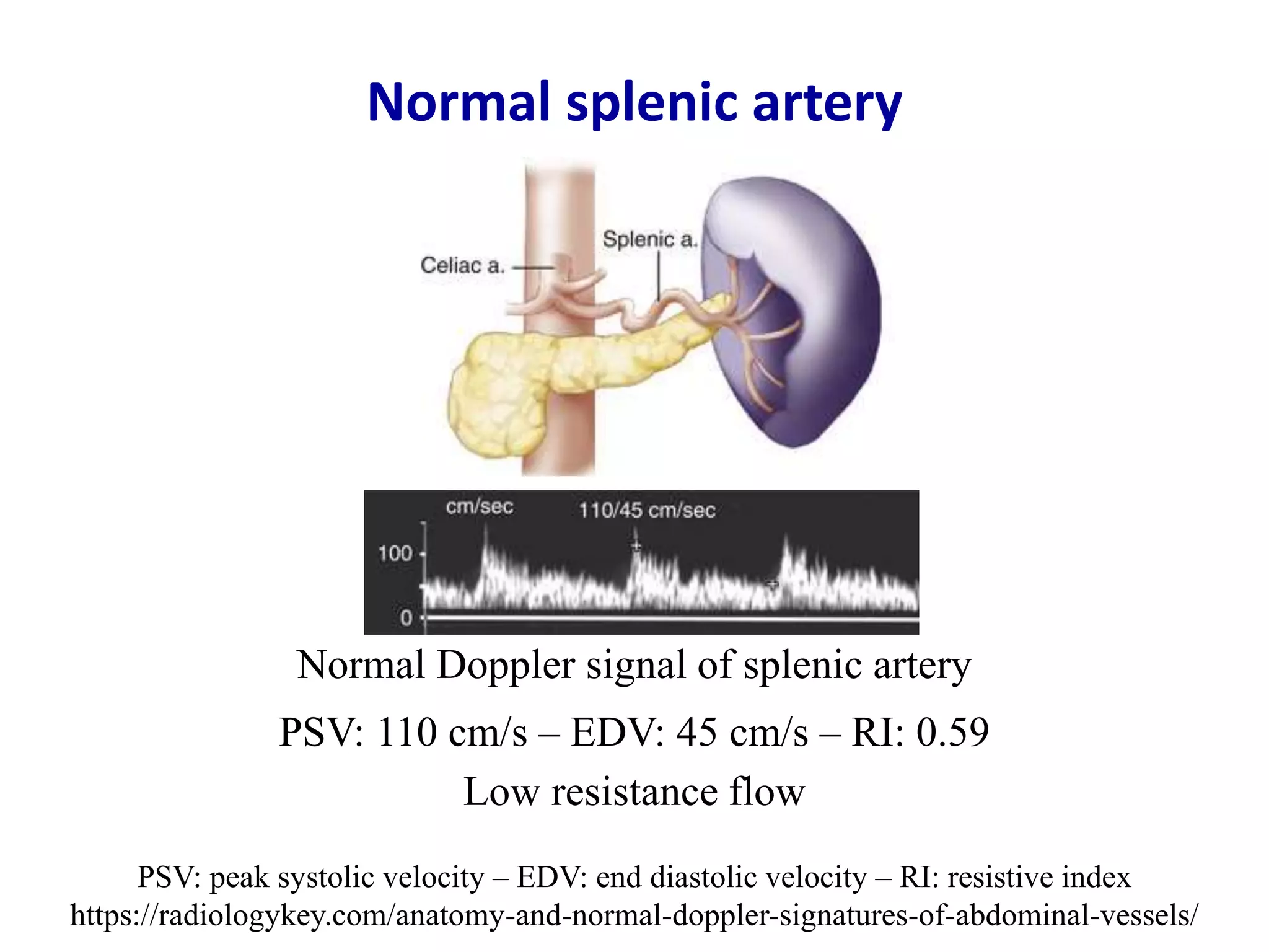 Doppler ultrasound of visceral arteries | PPTX