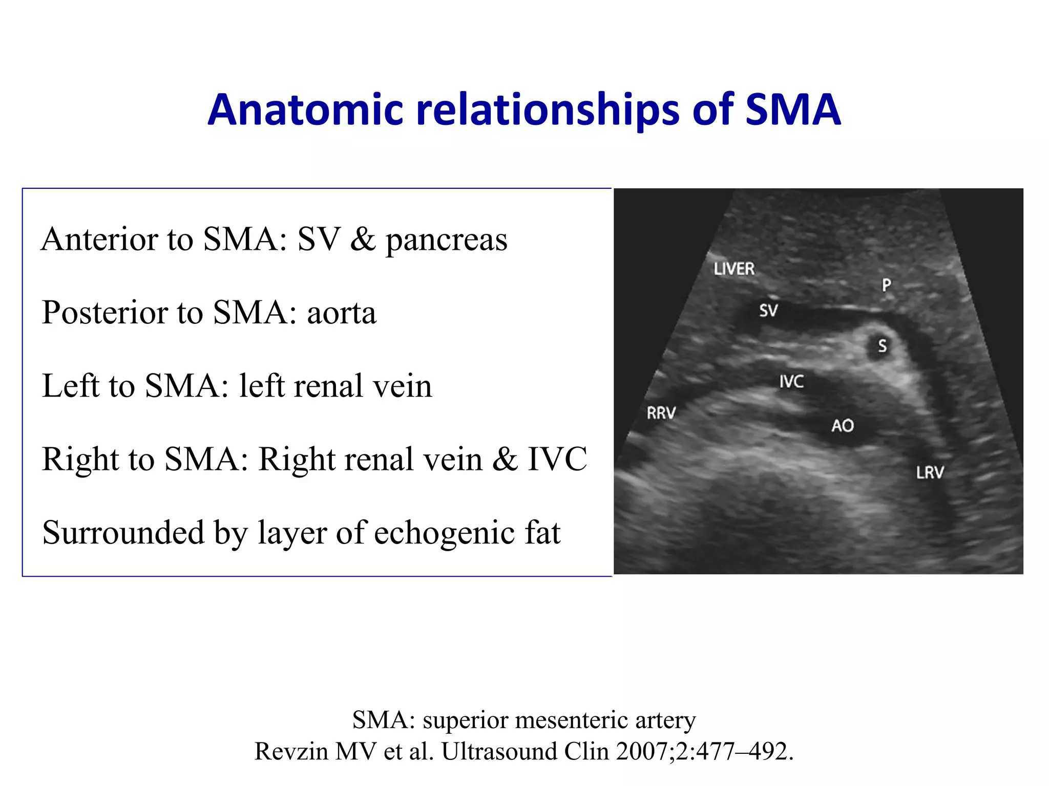 Doppler ultrasound of visceral arteries | PPTX