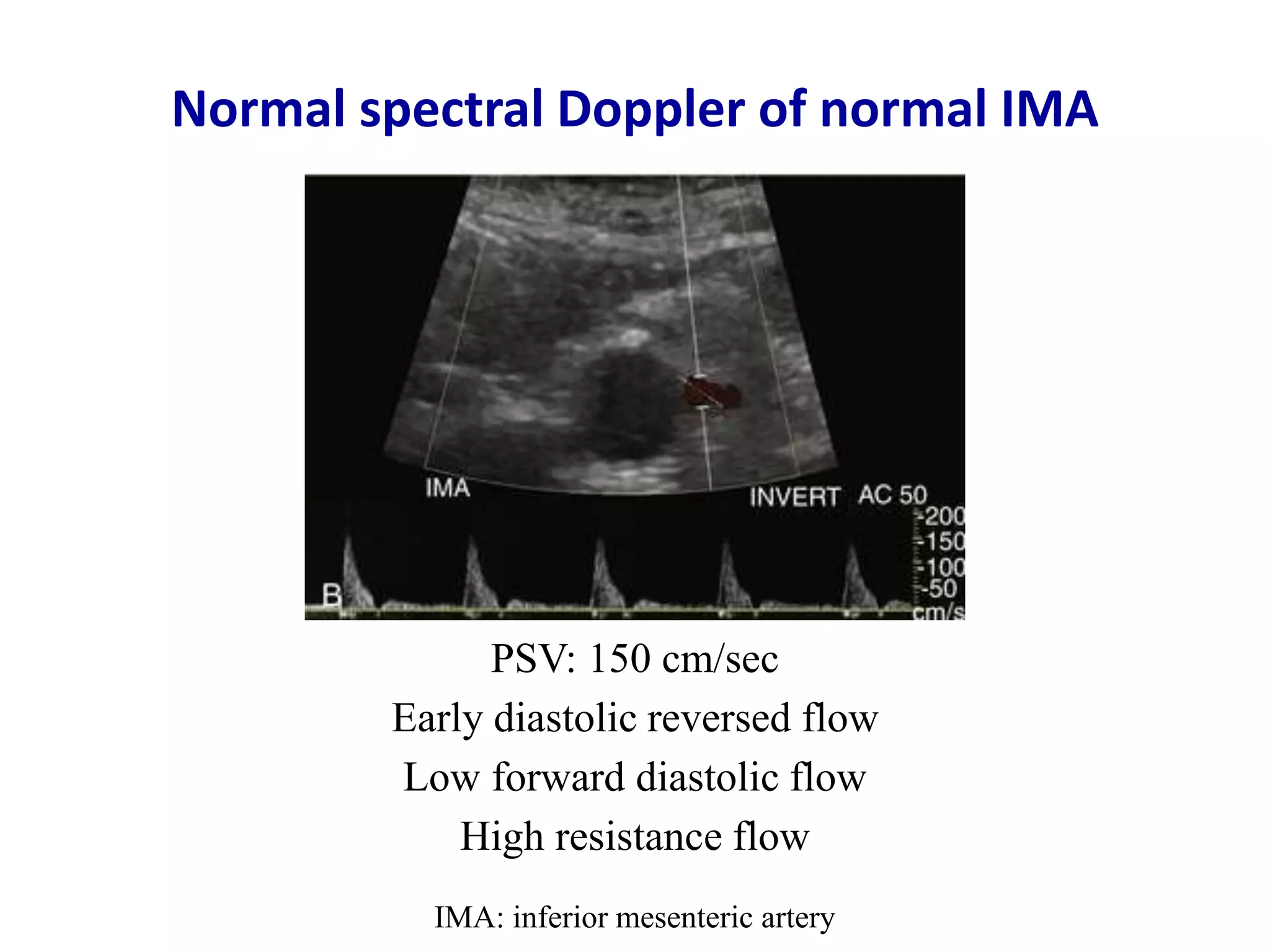 Doppler ultrasound of visceral arteries | PPTX