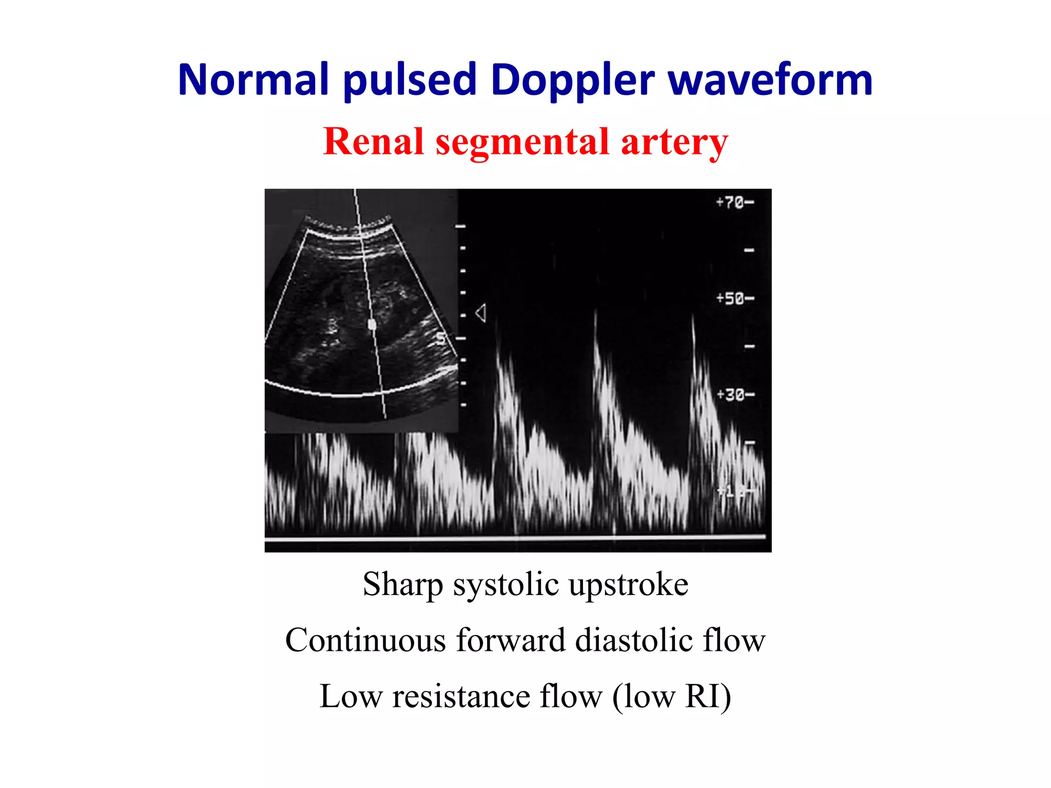 Doppler ultrasound of visceral arteries | PPTX