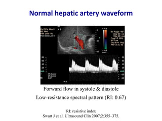 Doppler ultrasound of visceral arteries | PPTX