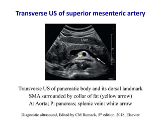 Superior Mesenteric Vein Ultrasound