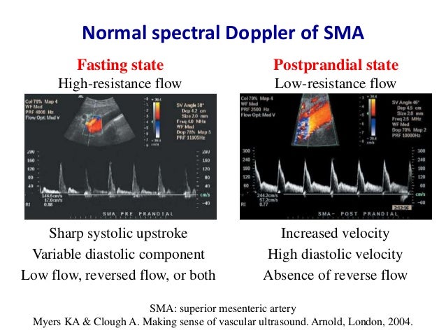 Doppler ultrasound of visceral arteries