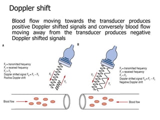 Doppler US in biomedical engineering and medical imaging | PPTX