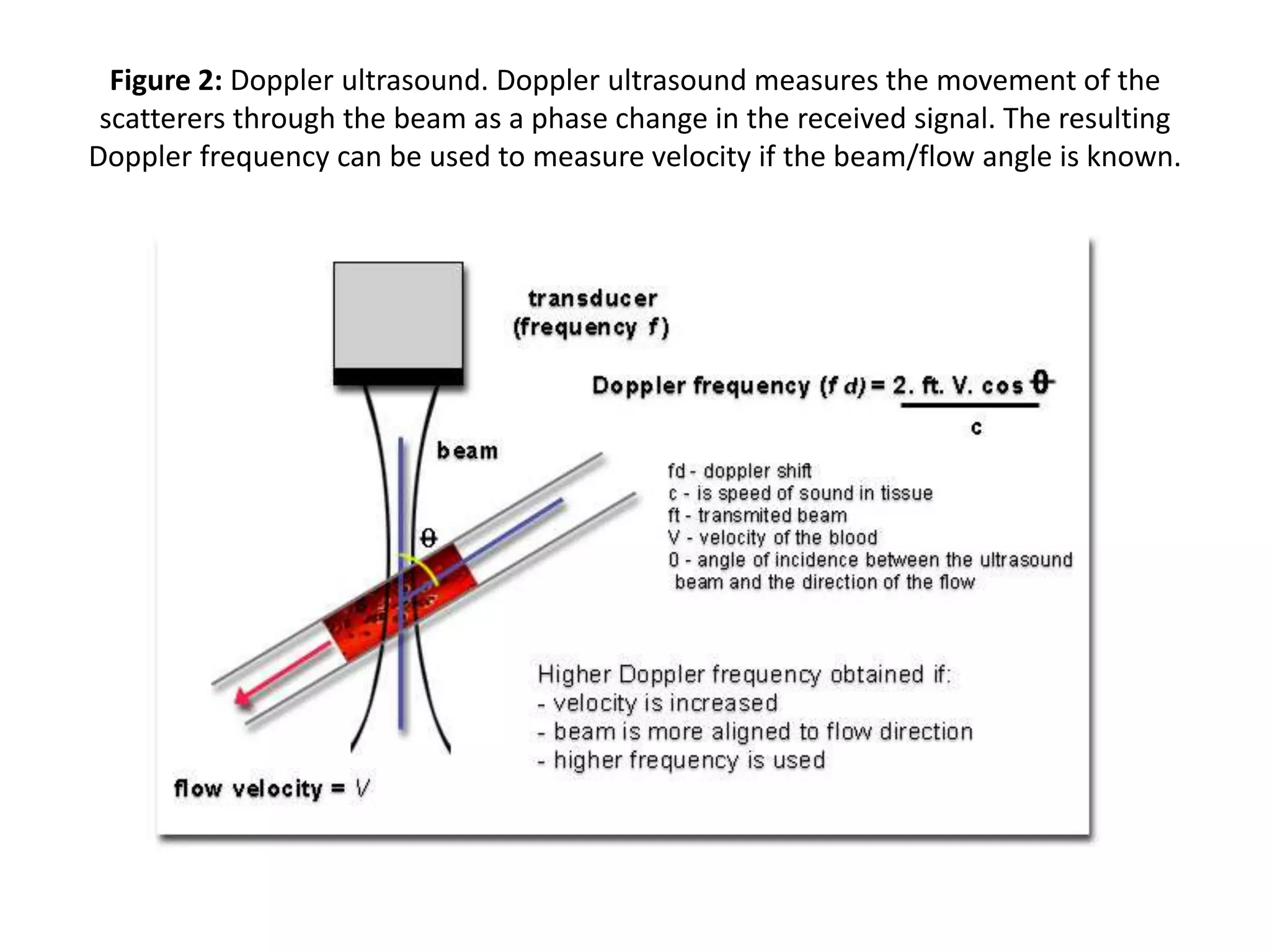 Doppler us (2) | PPTX