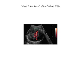 Doppler us (2) | PPT