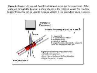 Doppler us (2) | PPTX