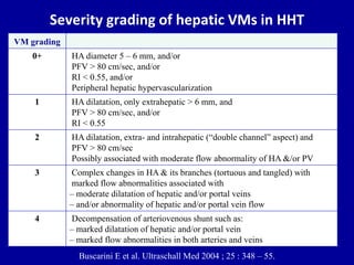 Doppler ultrasound of the liver in hereditary hemorrhagic ...